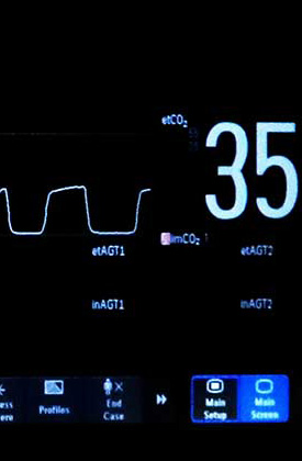 Vapor-Clean: charcoal filters for MH Malignant-Hyperthermia susceptible ...